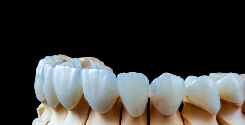 Pros and Cons of Teeth Reshaping | OC Dental Specialists